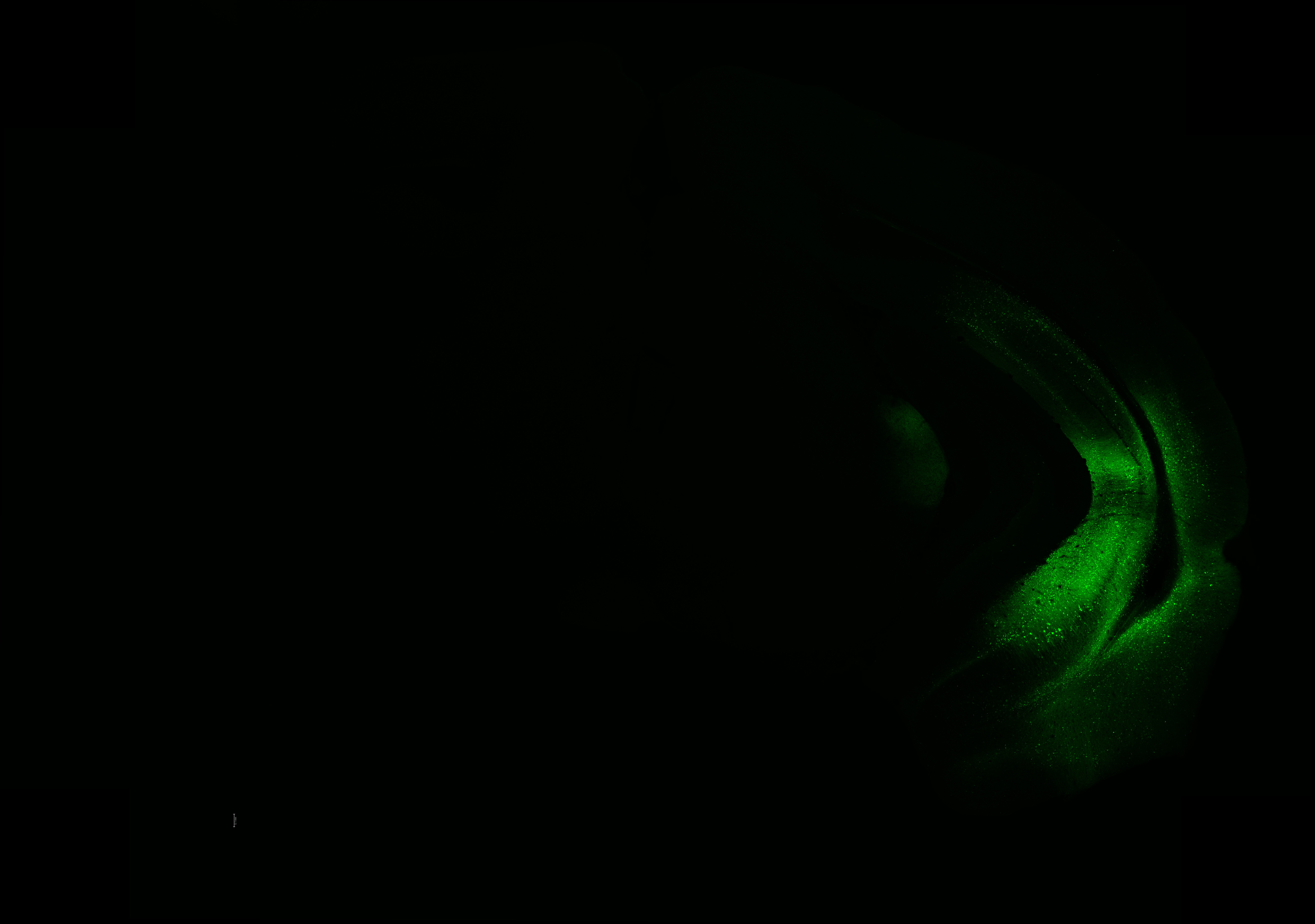 Addgene: AAV Data Hub - pAAV-CaMKIIa-hChR2(H134R)-EYFP in Mouse (AAV1)